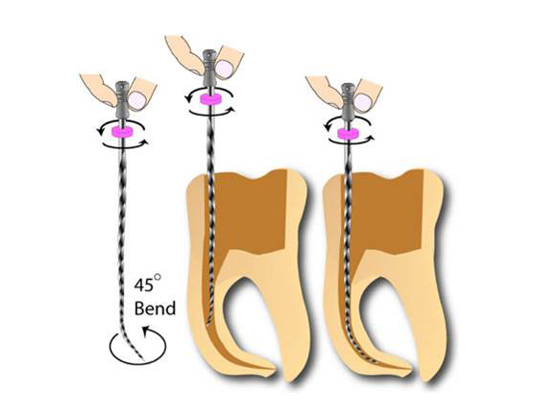 Instruction Of Use Rogin Rotary Files-Super Flexi Files - RoginDental