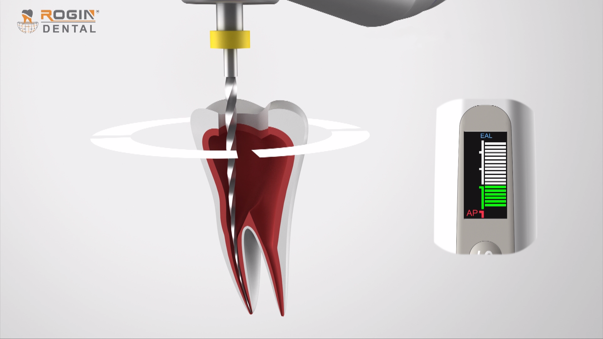 How To Properly Use Your Apex Positioner - RoginDental